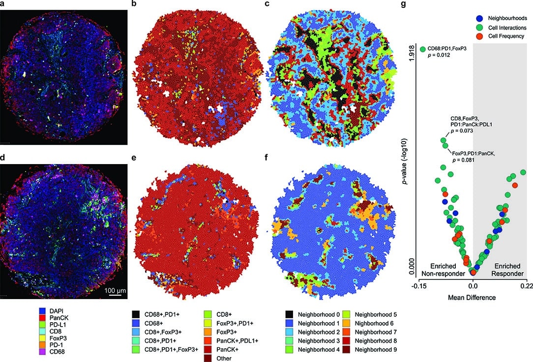 Human Tissue Samples for Oncology Research | TriStar