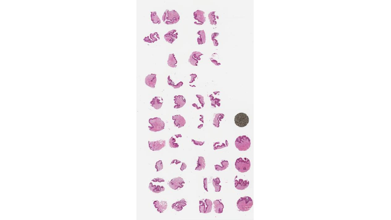 Normal (non-malignant) skin (TA2474) - TriStar Technology Group