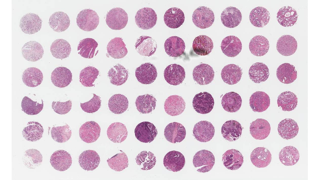 RNAscope pre-qualified multi tumor array, 2mm core diameter, TMA1 ...